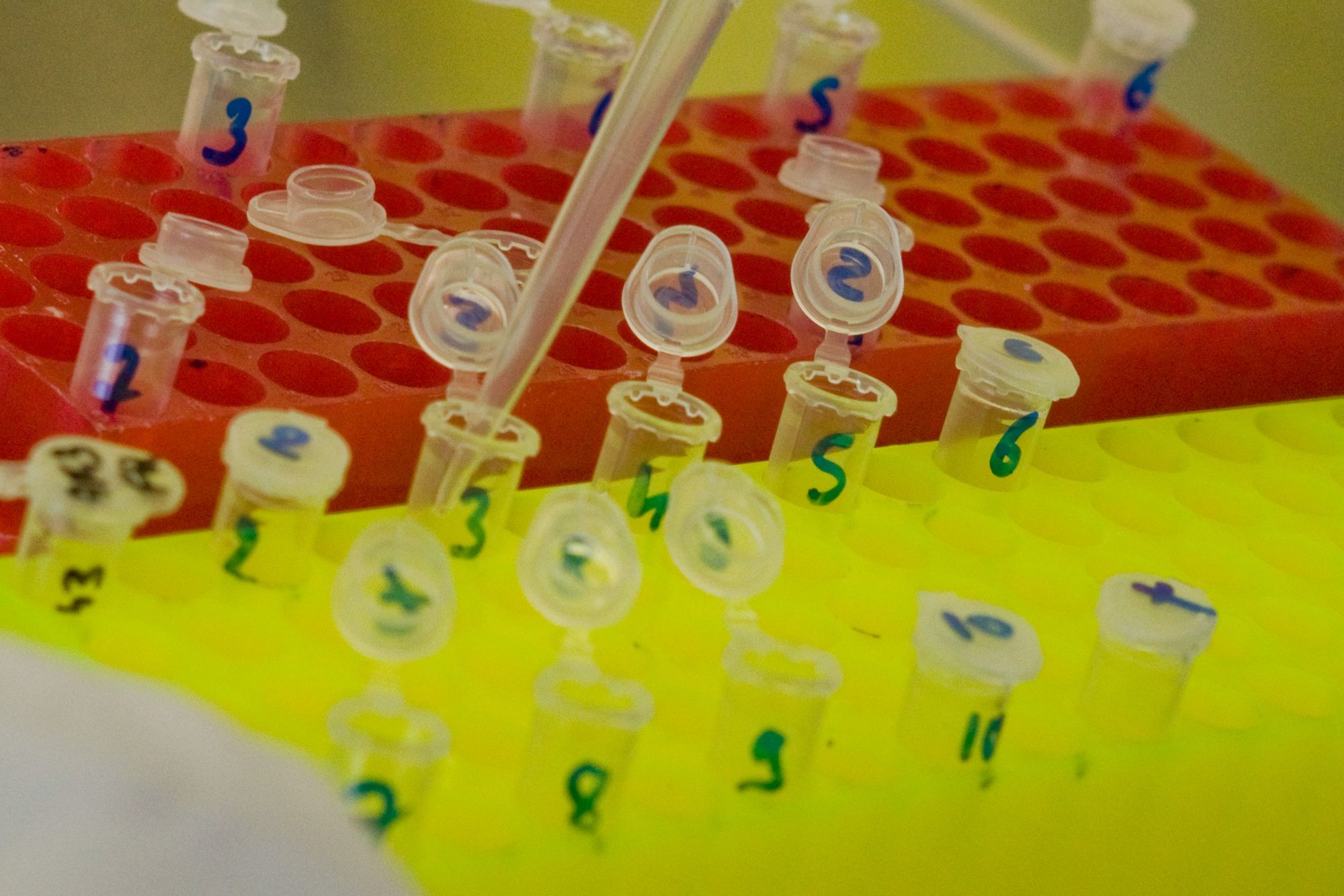 Morteau : les tests au labo seront élargis à partir du 11 mai